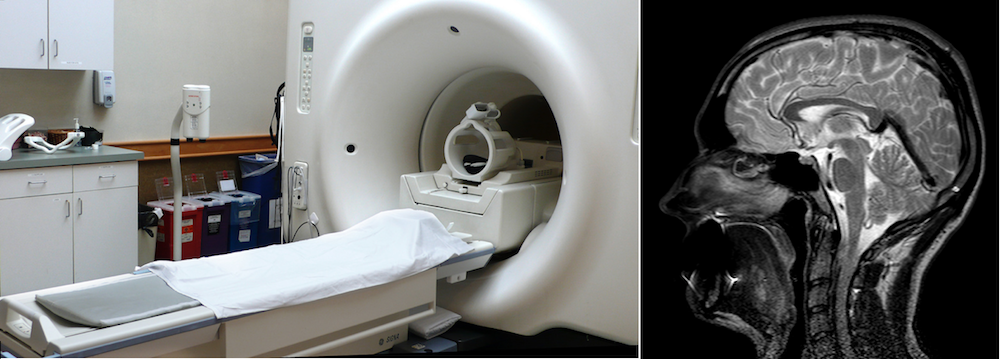 Designing and Optimizing MRI Birdcage Coils Using Simulation | COMSOL Blog