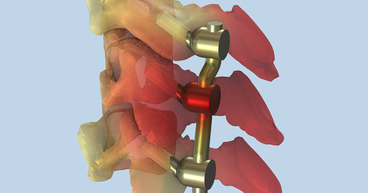 Thoughts on AI and CEM43 in Medical Device Design | COMSOL Blog